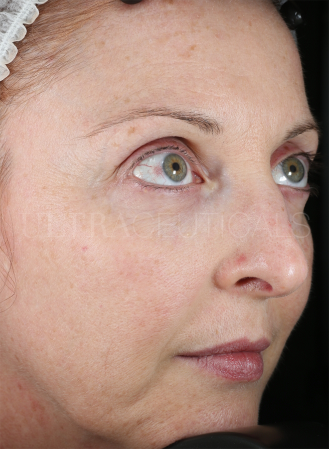 Ultra A Perfecting Intense Booster Online – Ultraceuticals AU